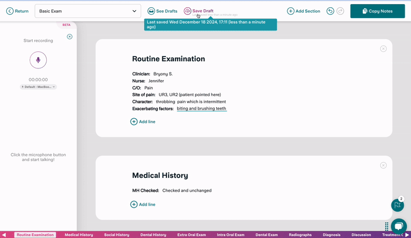 Taking Notes using Kiroku